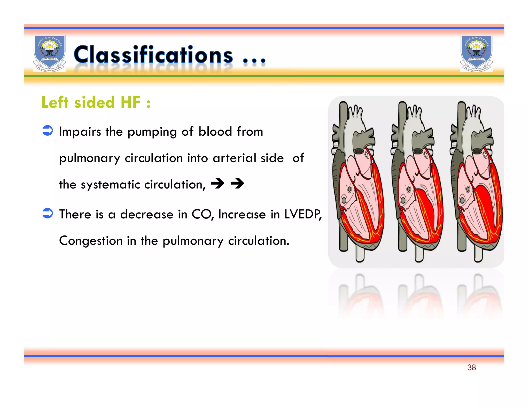 Heart failure | PDF