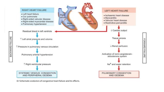 Heart failure: definition,signs,symptoms,lab values, tests ...