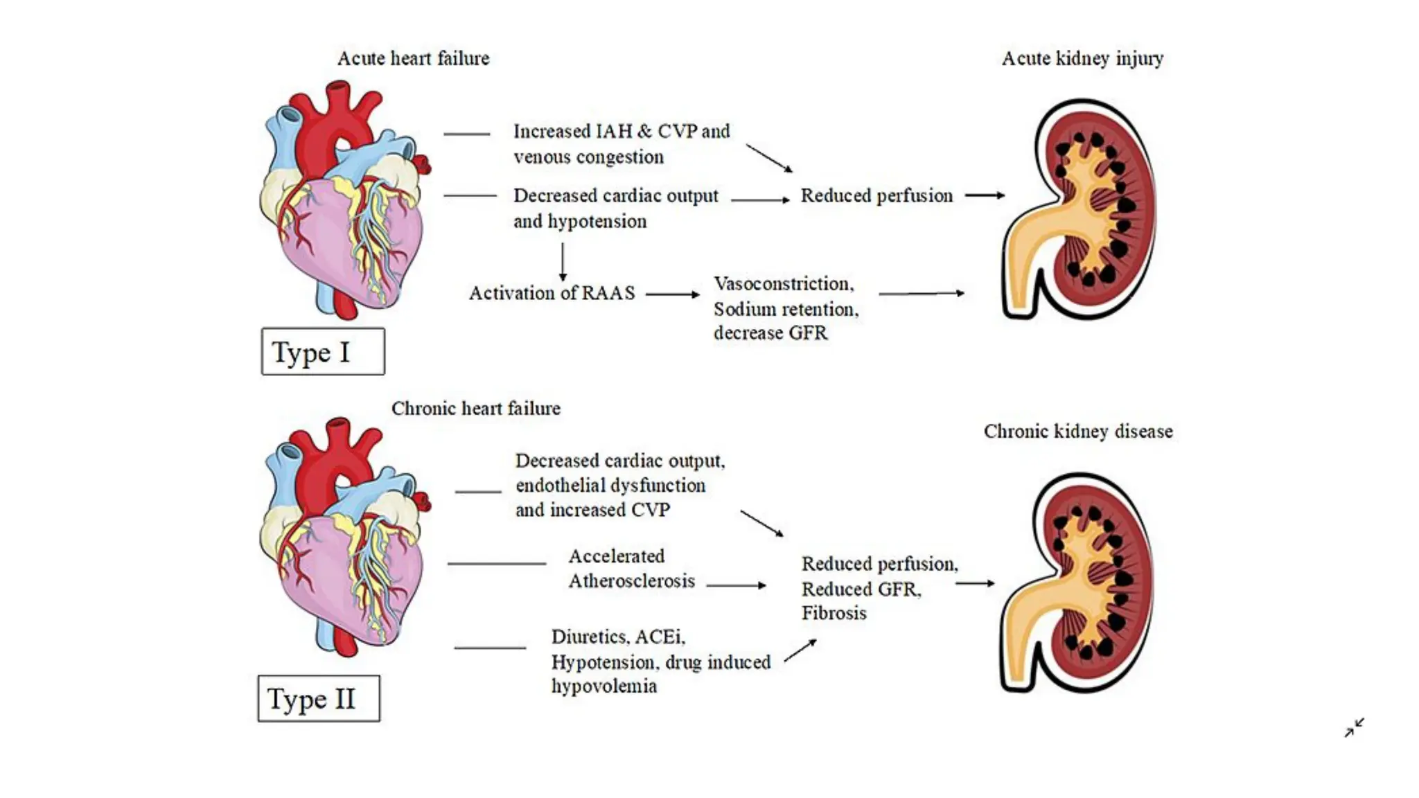 HEART FAILURE ( based on Harrison's Textbook of Medicine ) .pdf