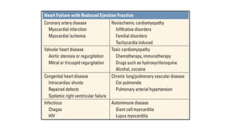 HEART FAILURE ( based on Harrison's Textbook of Medicine ) .pdf