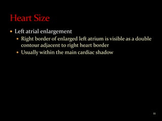 Heart failure radiology group1 year 5 10-11 | PPTX