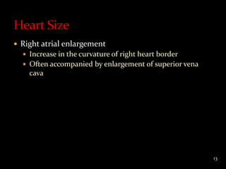 Heart failure radiology group1 year 5 10-11 | PPTX