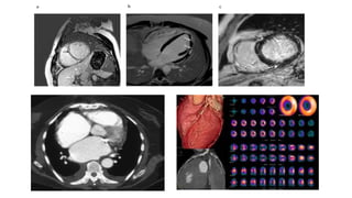 Heart Failure etiology investigations and | PPTX