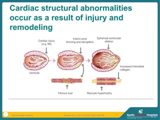 Heart failure: Basic Cocepts | PPTX