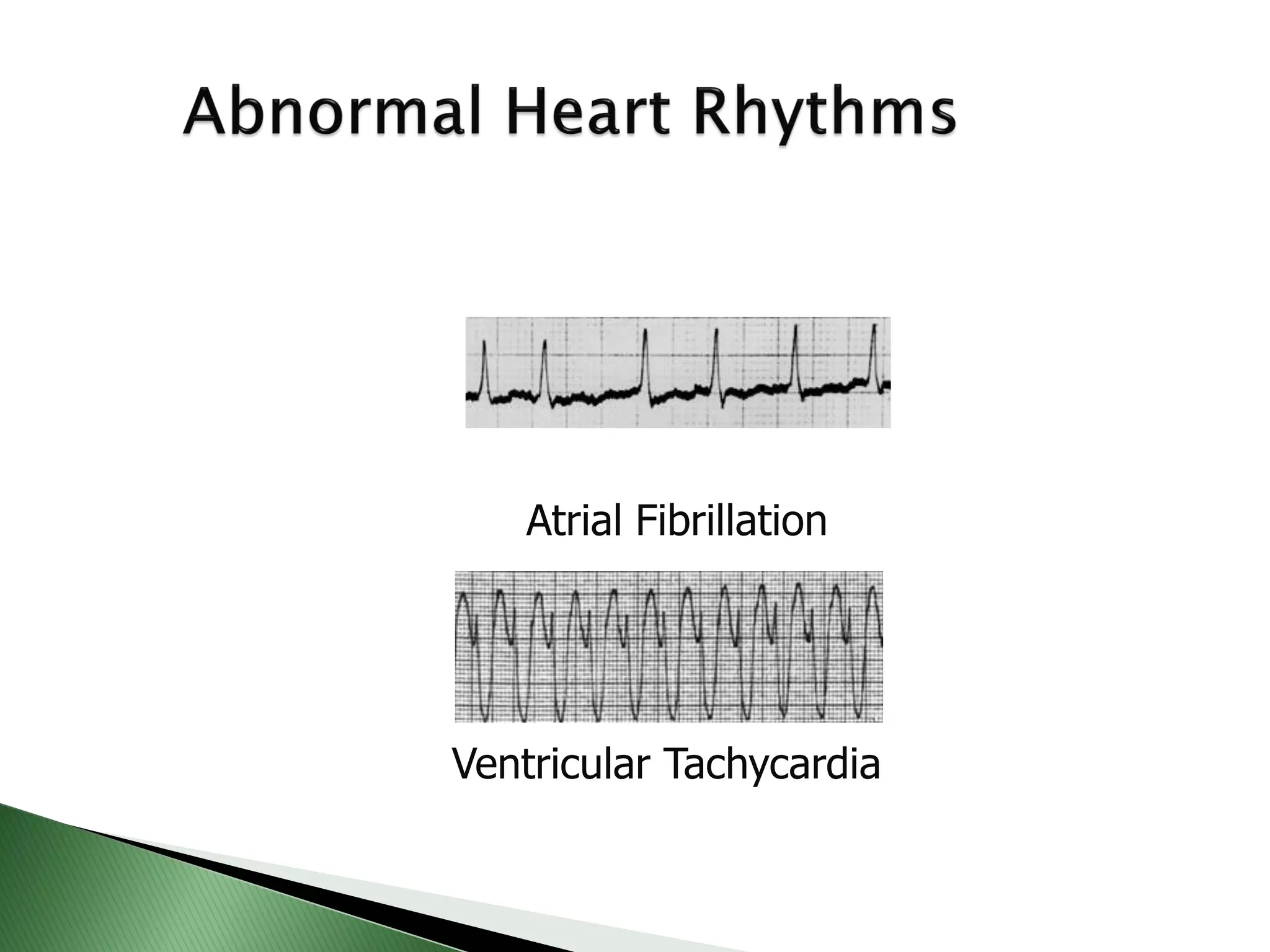 Heart failure arrhythmic and angina - Pharmacology | PDF | Heart and ...