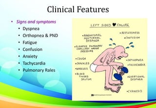 Heart failure - Dr M A Lateef Siddiqui | PPT