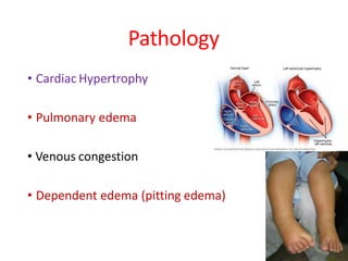 heart failure in children and pediatrics) | PPTX