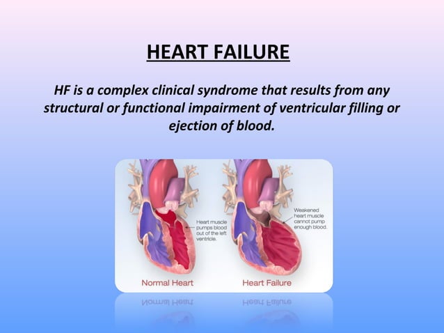 Heart failure ppt | PPT