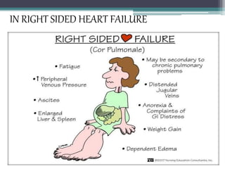 Heart failure | PPTX