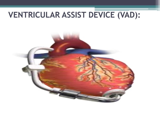 Heart failure | PPTX