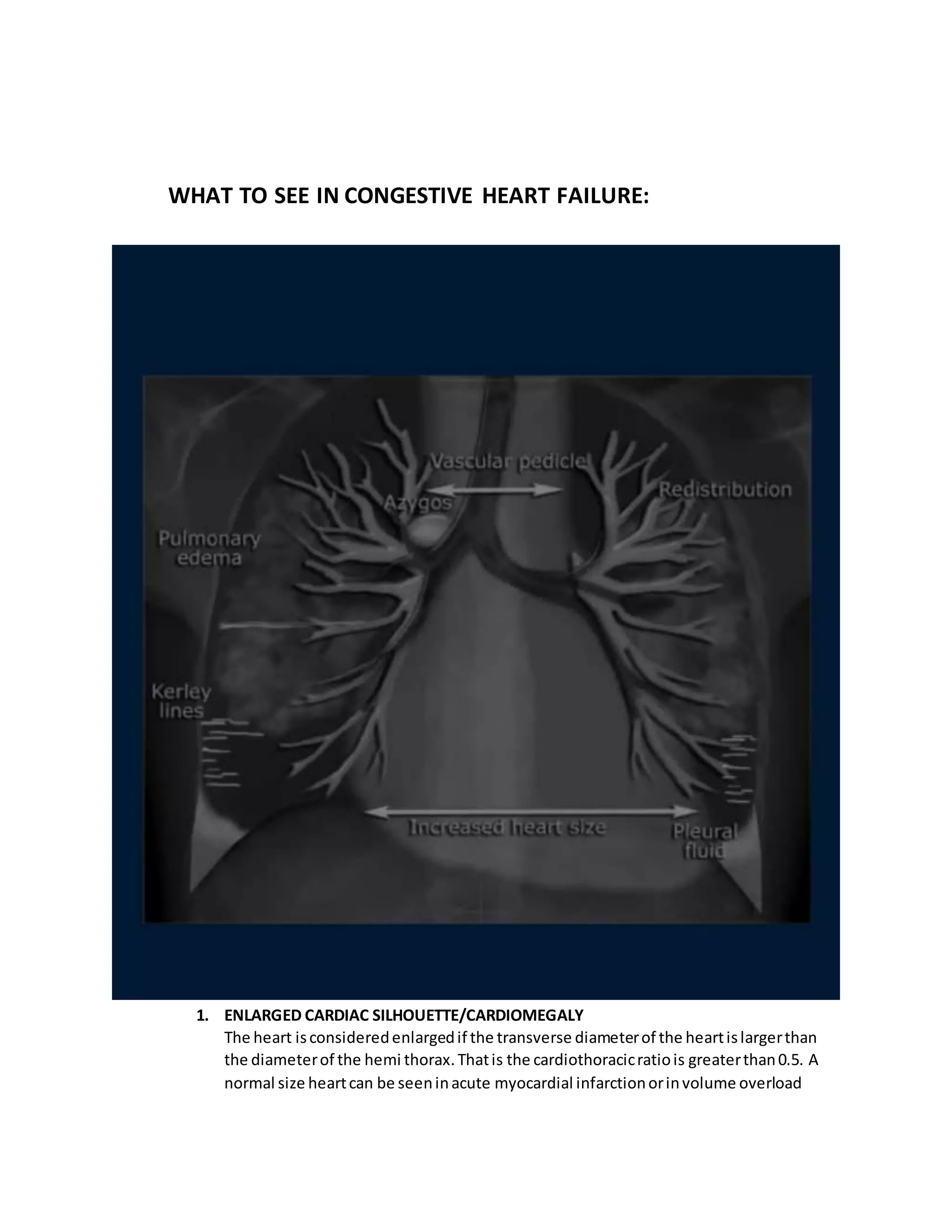 Heart failure radiology | DOCX | Heart and Cardiovascular Diseases ...