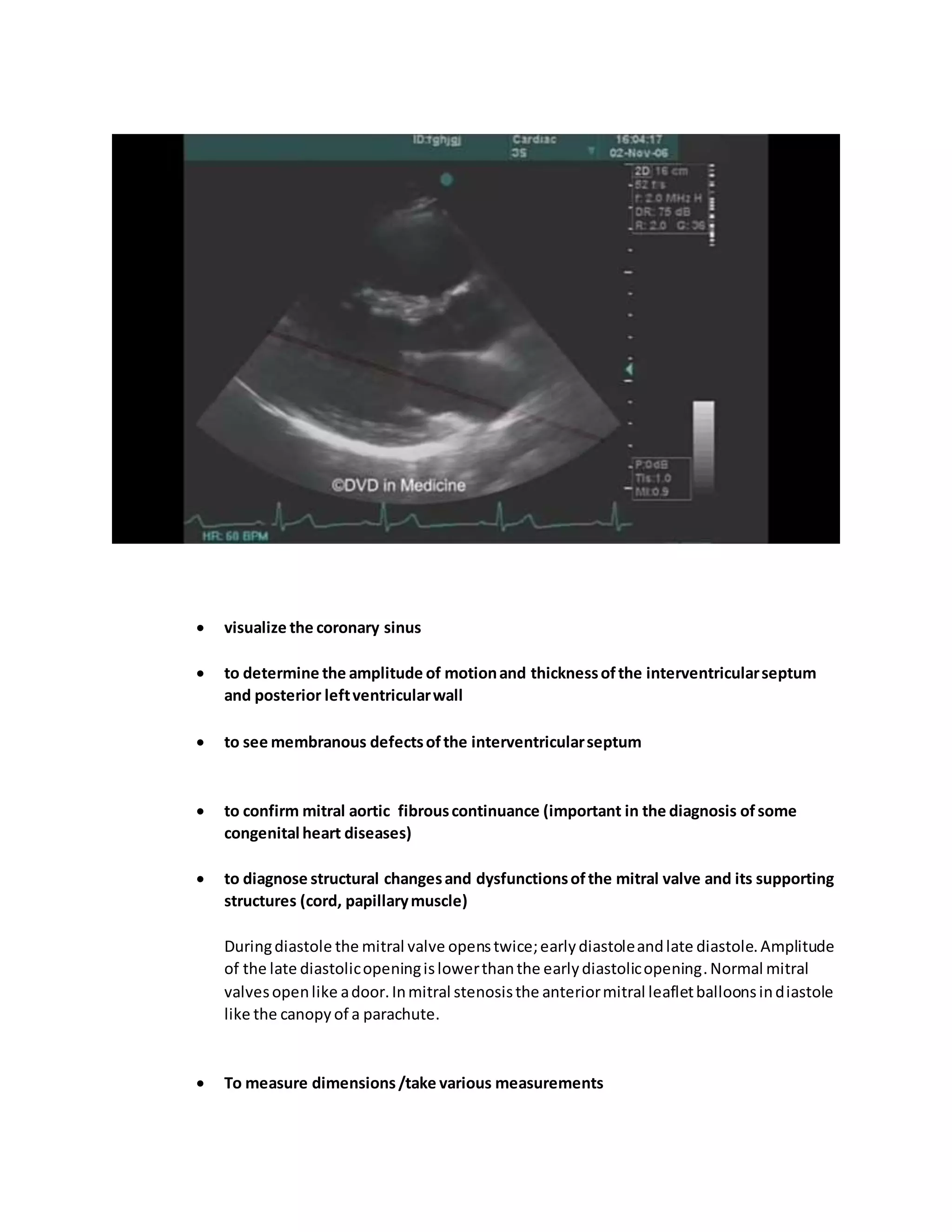 Heart failure radiology | DOCX | Heart and Cardiovascular Diseases ...