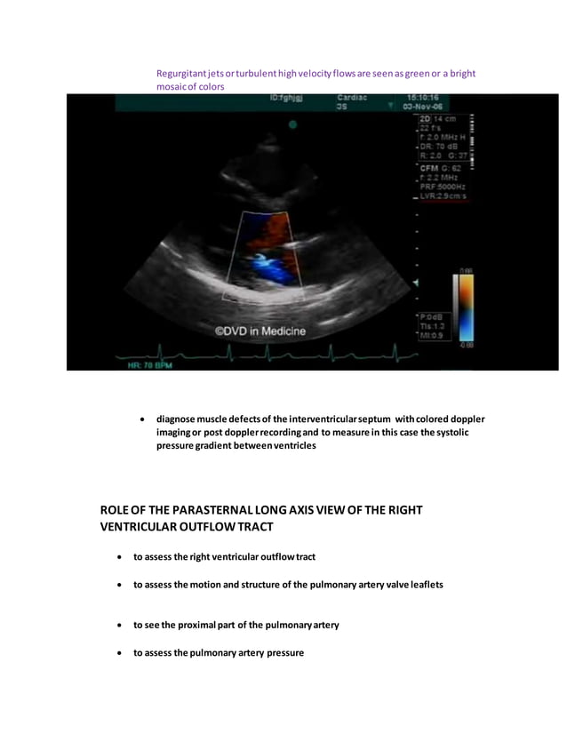Heart failure radiology | PDF
