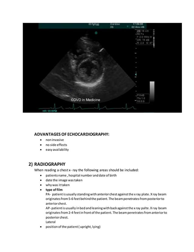 Heart failure radiology | PDF