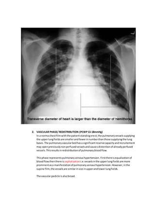 Heart failure radiology | DOCX | Heart and Cardiovascular Diseases ...