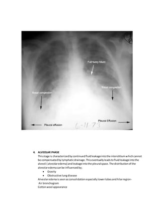 Heart failure radiology | DOCX | Heart and Cardiovascular Diseases ...