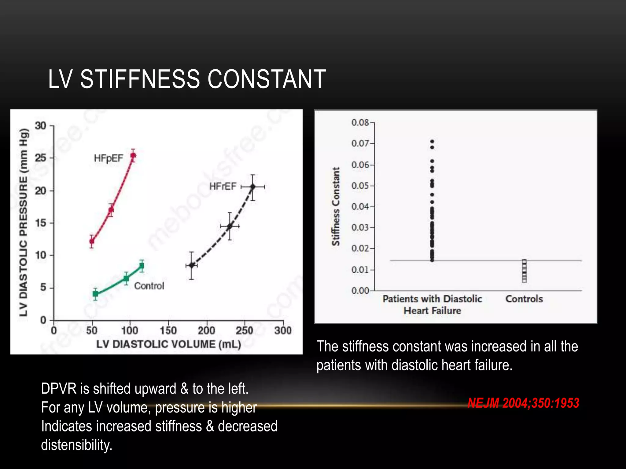 Heart failure with preserved ejection fraction | PPTX