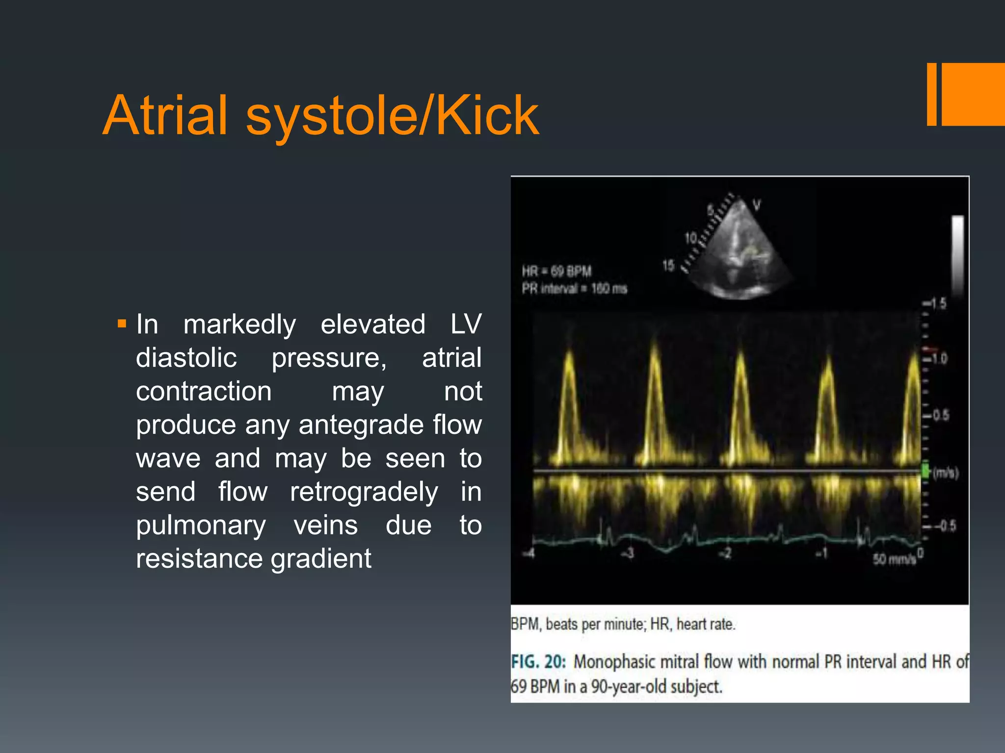 Heart failure with preserved ejection fraction | PPTX