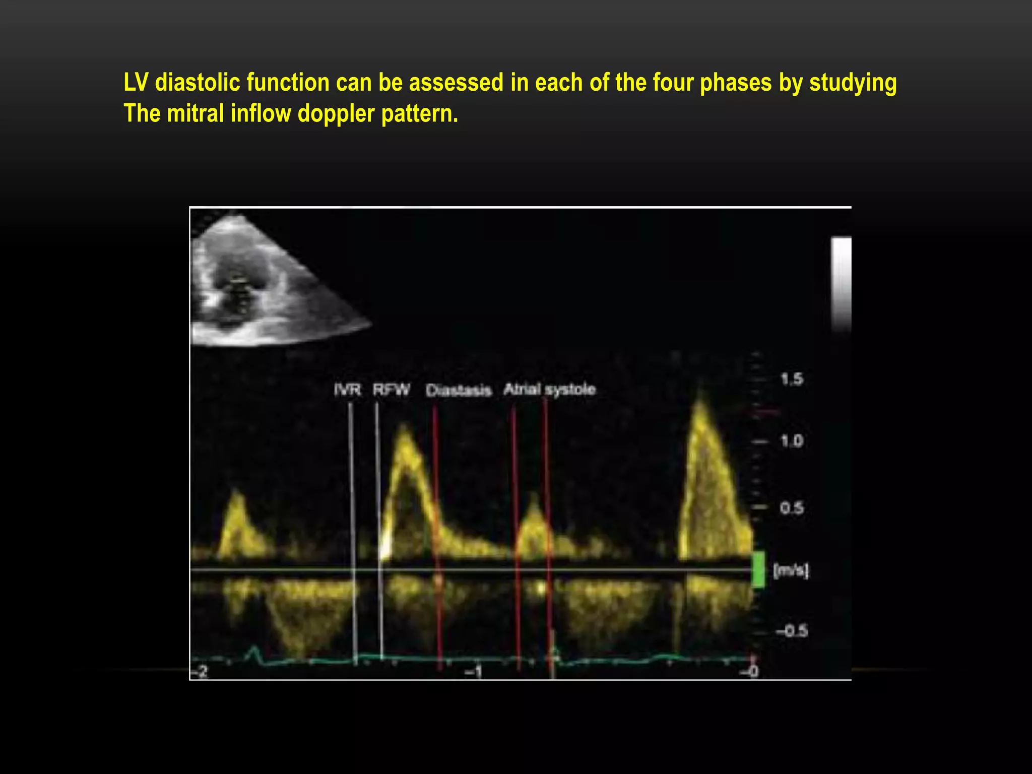 Heart failure with preserved ejection fraction | PPTX