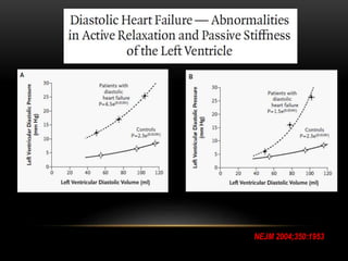 Heart failure with preserved ejection fraction | PPTX
