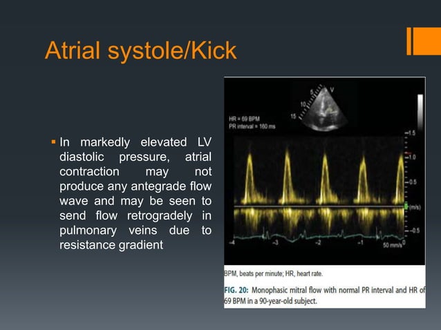 Heart failure with preserved ejection fraction | PPTX