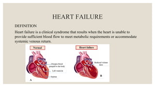 HEART FAILURE.pptx