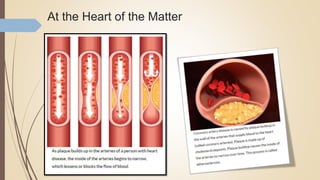 Heart Health - A Healthy Living Model | PPT