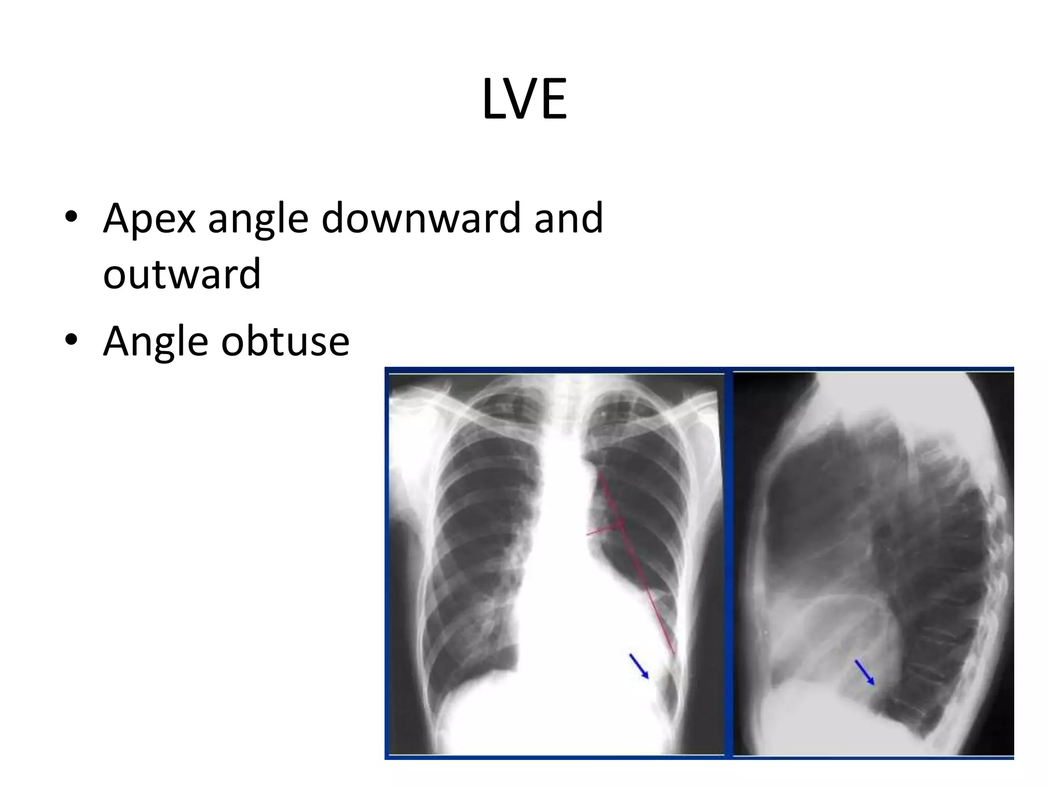Heart imaging RADIOLOGY DEPT | PPTX