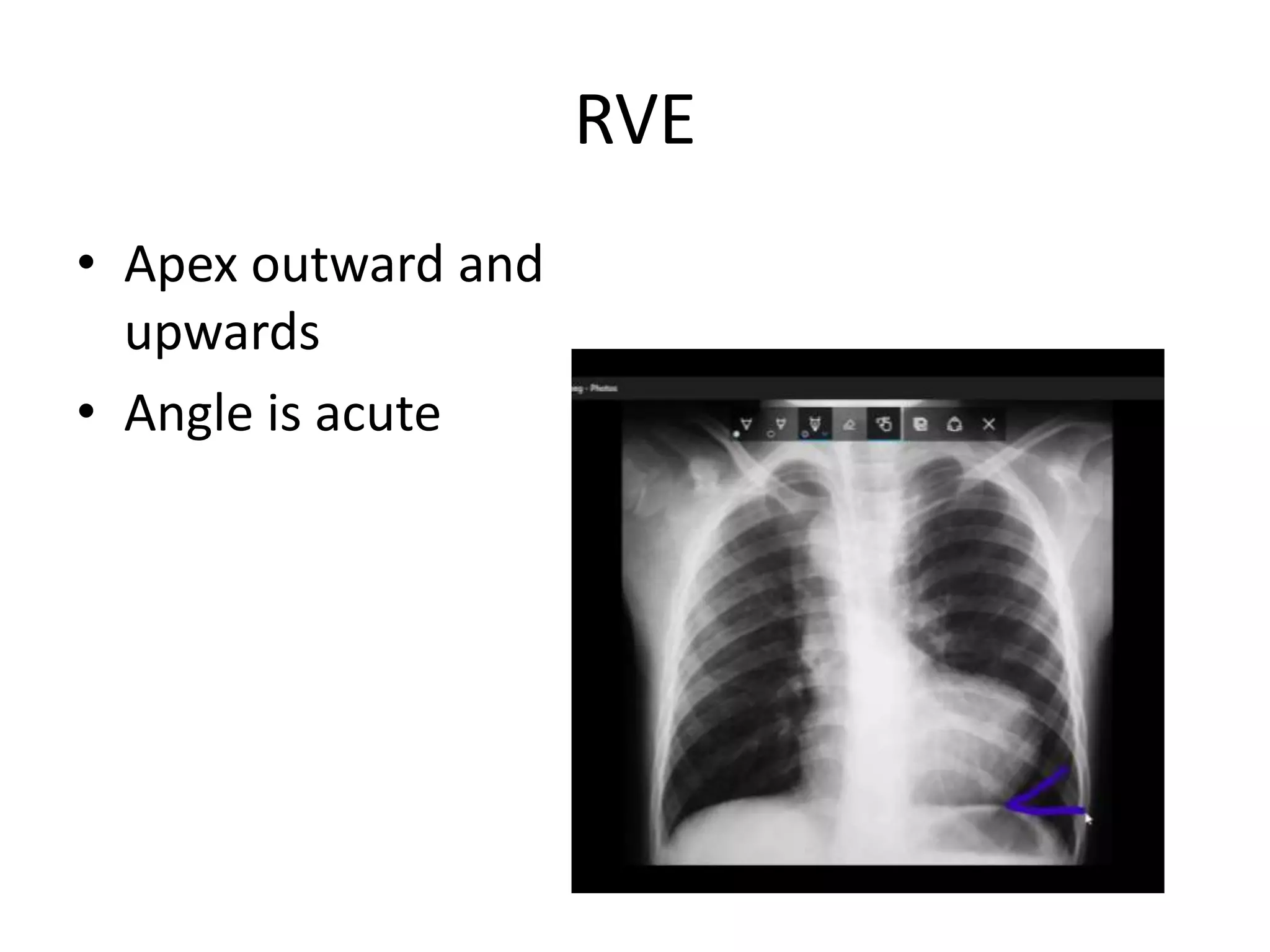 Heart imaging RADIOLOGY DEPT | PPTX