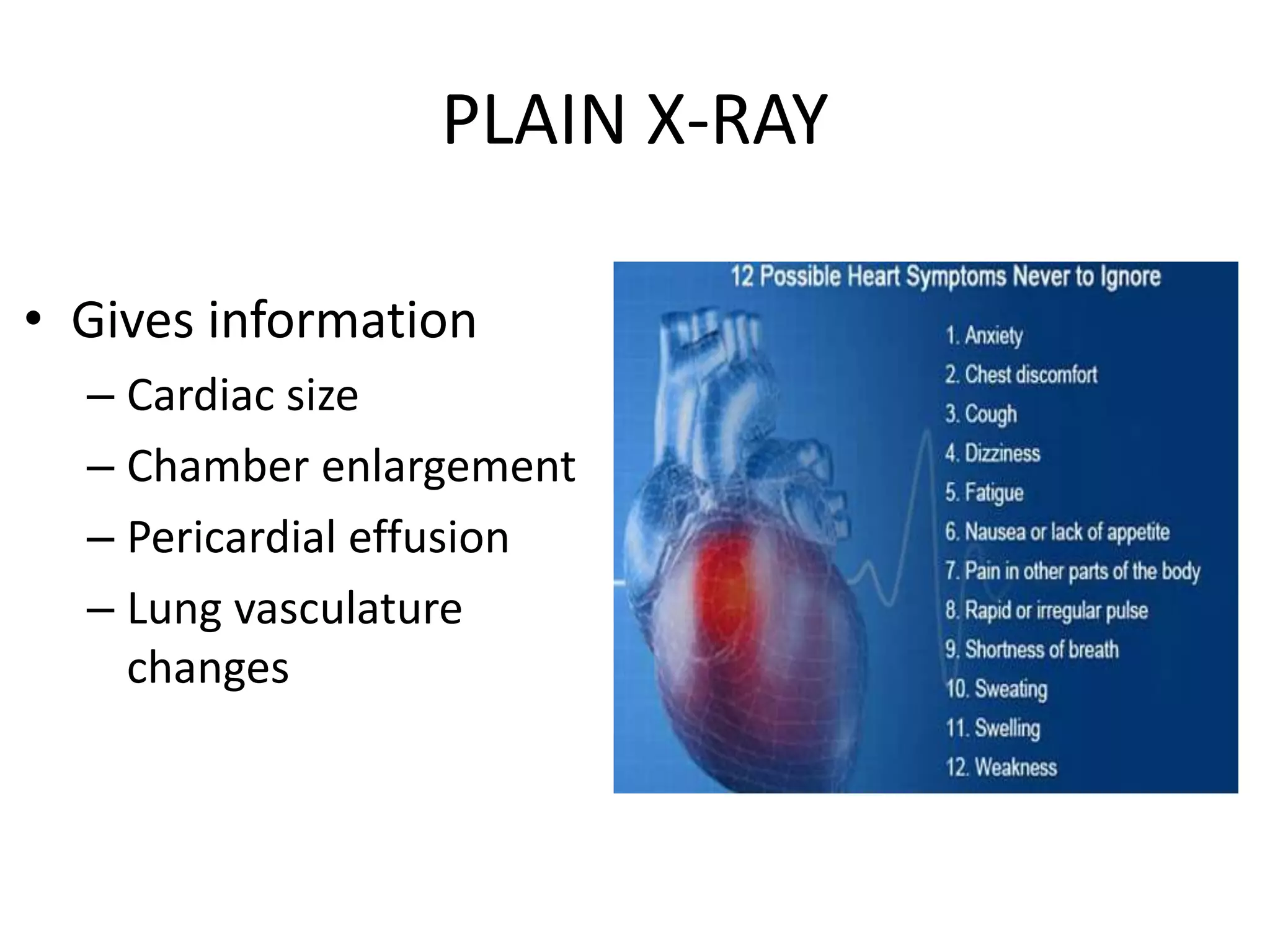 Heart imaging RADIOLOGY DEPT | PPTX