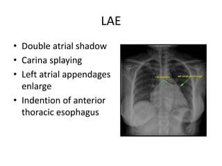 Heart imaging RADIOLOGY DEPT | PPTX