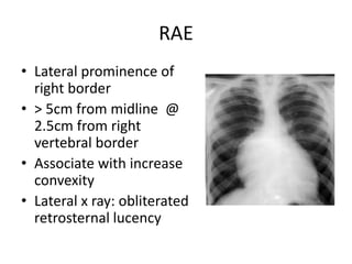 Heart imaging RADIOLOGY DEPT | PPTX