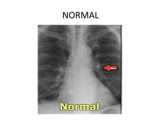 Heart imaging RADIOLOGY DEPT | PPTX