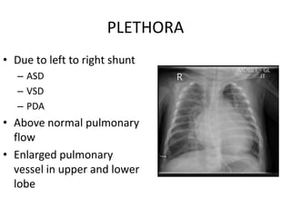 Heart imaging RADIOLOGY DEPT | PPTX