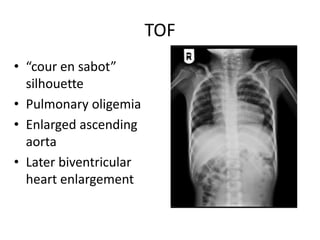 Heart imaging RADIOLOGY DEPT | PPTX