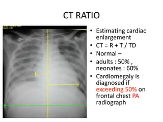 Heart imaging RADIOLOGY DEPT | PPTX
