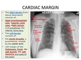 X Ray Heart Anatomy