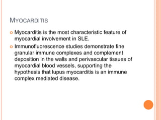 Heart involvement in systemic lupus erythematosus, | PPTX