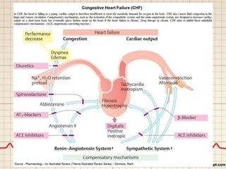 CHF (Congestive Heart Failure) | PPT