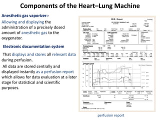 Heart–lung machine | PPSX