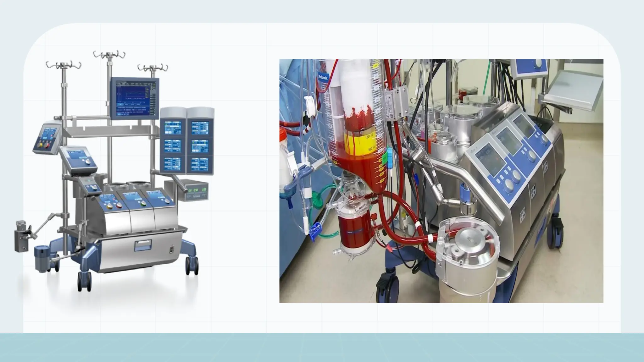 Heart lung machine and its components.pptx