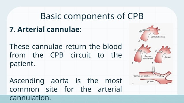 Heart lung machine and its components.pptx | Lung and Respiratory ...