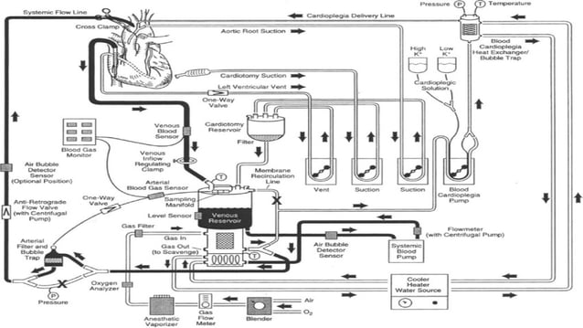 Heart lung machine and its components.pptx | Lung and Respiratory ...