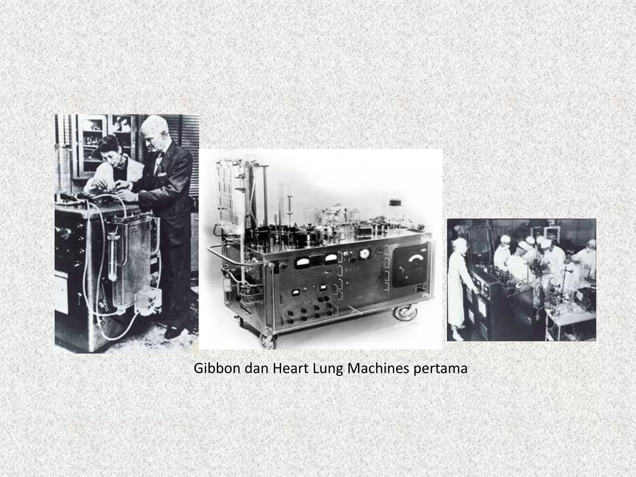 Heart Lung Machines.ppt