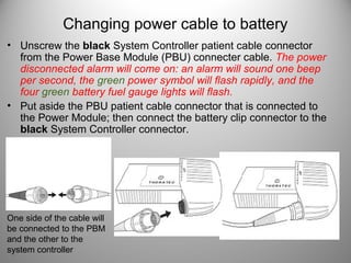 Heart mate ii lvad basic user updated per moses cone | PPT