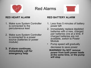 Heart mate ii lvad basic user updated per moses cone | PPT