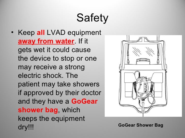 Heart mate ii lvad basic user updated per moses cone
