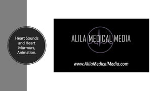 Heart murmurs | PPT