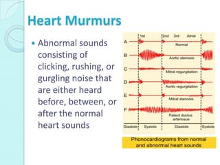 Heart sound analysis | PPTX