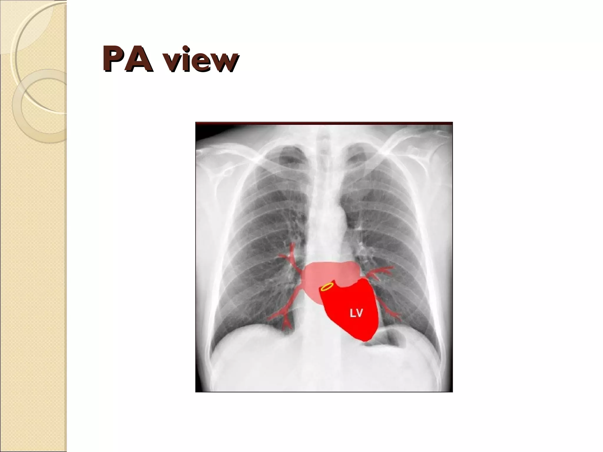Heart & pericardium | PPT
